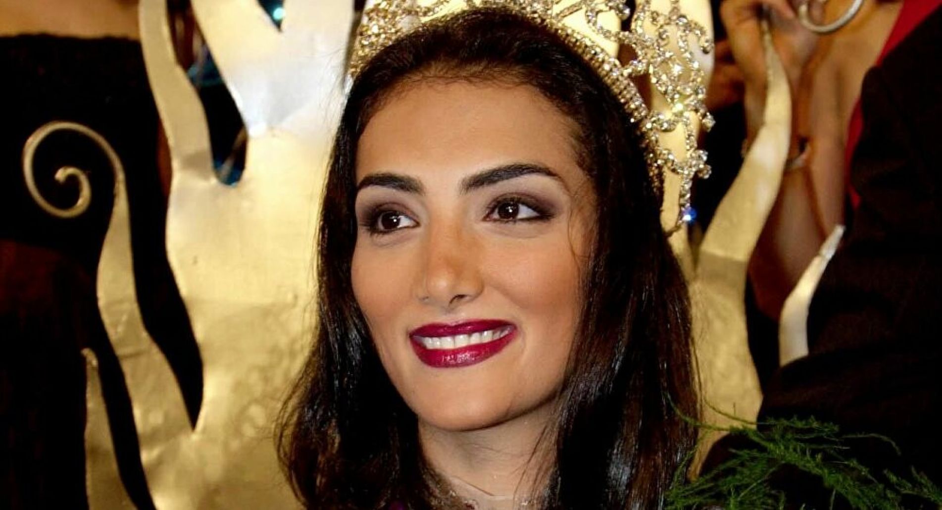 حورية فرغلي قبل وبعد التجميل في 30 لقطة،ملكة الجمال الذي تشوه أنفها في